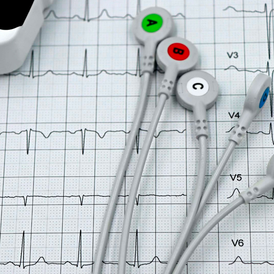 Holter 24 horas